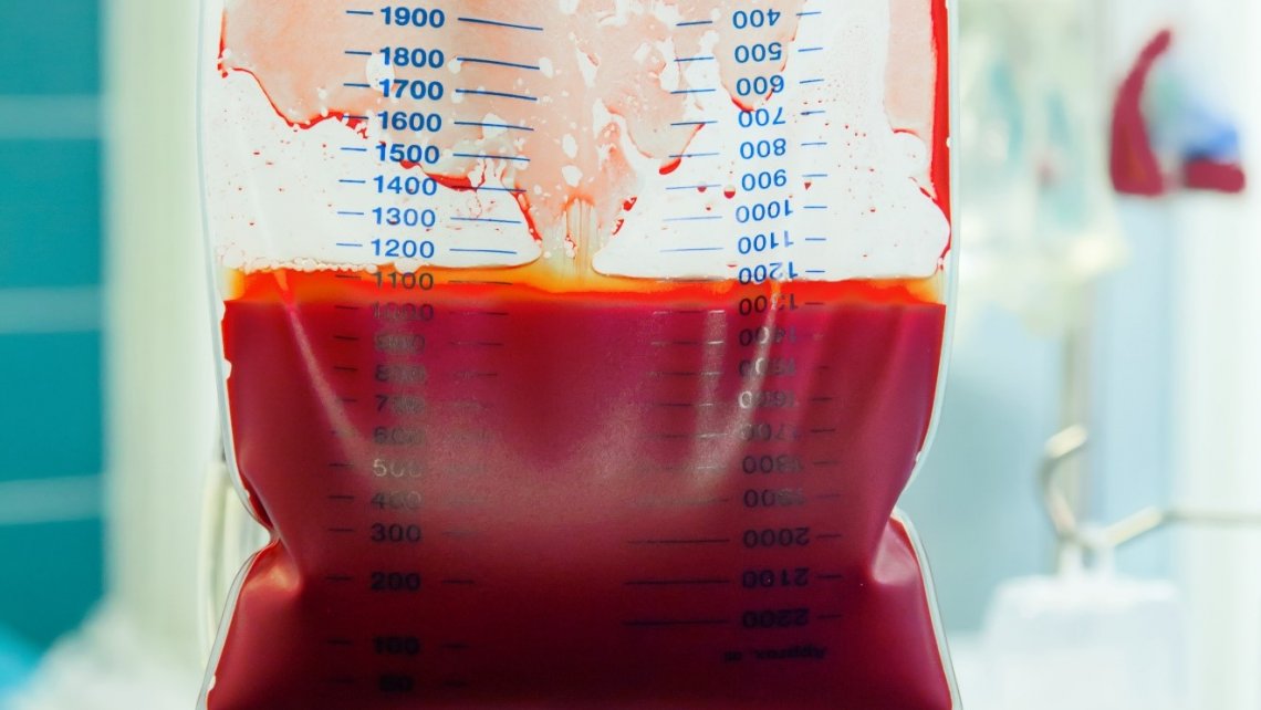 Use of Intraoperative Blood Autotransfusion in Obstetrics - Perfusion Times